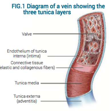 Peripheral IV cannulae (PIVC): Saving a line might just save a life ...